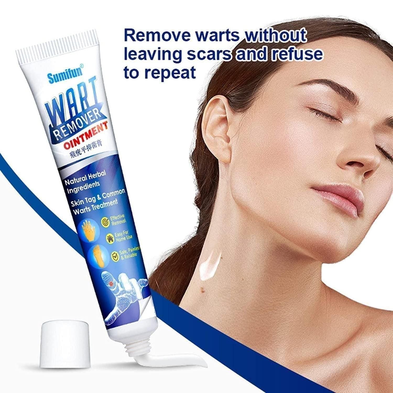 The Original Wart / Massa Removal Cream – Homely Dezires